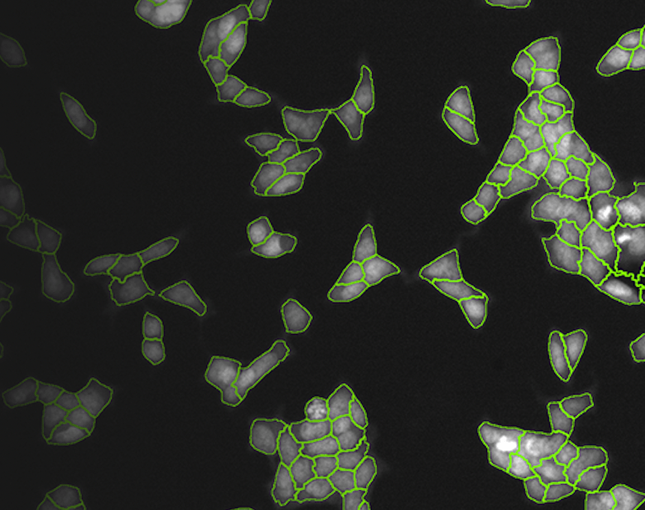 Automated Adherent Cell Counting with CELENA-X High-Content System