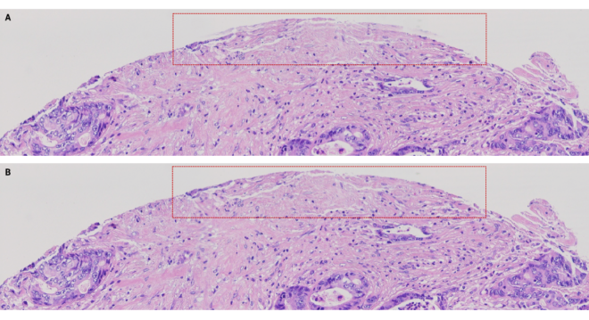 Seamless Image Stitching with CELENA-X High Content Imaging
