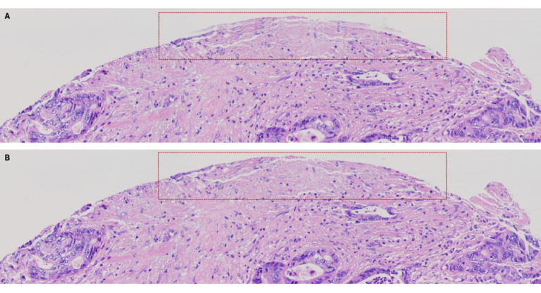 Seamless Image Stitching with CELENA-X High Content Imaging
