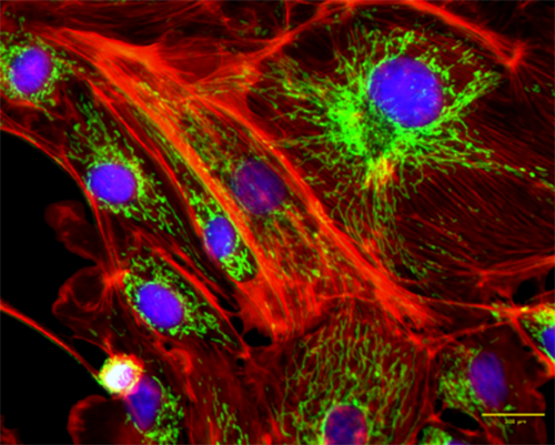 BPAE cells imaged with the CELENA® S – Logos Biosystems | Advanced ...