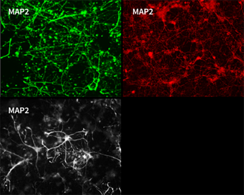 Mouse neuron primary cultures imaged with the CELENA® S – Logos Biosystems