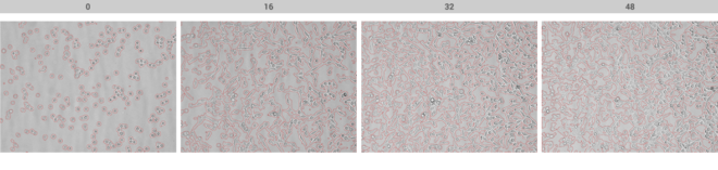 Automated Adherent Cell Confluency Monitoring with CELENA‑X