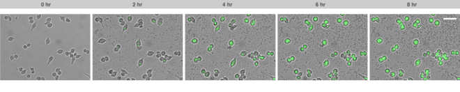 Live-Cell Phagocytosis Assay with CELENA-X High-Content System