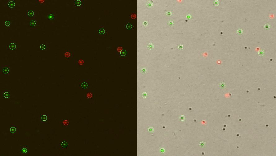 Mouse splenocyte – Logos Biosystems | Advanced Imaging Solutions for ...