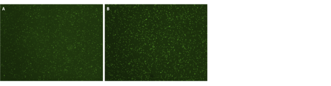 Fast Cell Counting and Viability Measurement of Yeast Cells with the ...