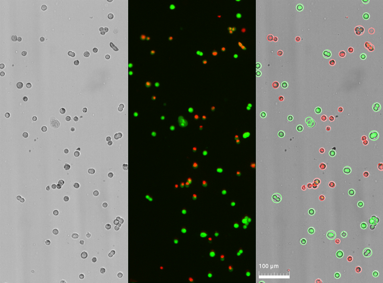 AsPC-1 – Logos Biosystems | Advanced Imaging Solutions for Research ...