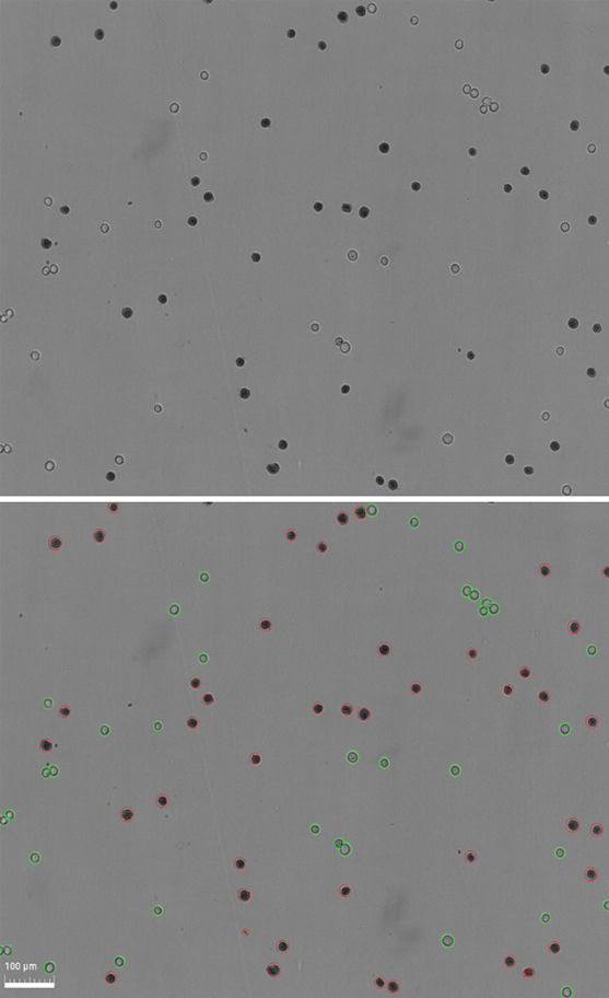 U2OS – Logos Biosystems | Advanced Imaging Solutions for Research ...