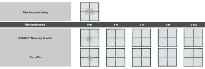 The X-CLARITY™ Mounting Solution I Logos Biosystems