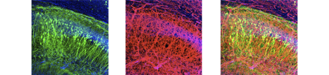 Preserve Fluorescent Signals with X-CLARITY™