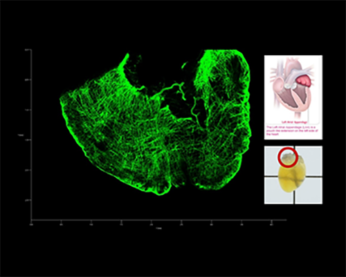 Mouse coronary artery – Logos Biosystems | Advanced Imaging Solutions ...