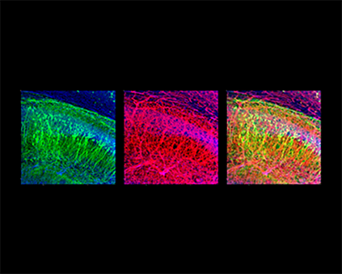 Thy1-YFP transgenic mouse brain | Logos Biosystems