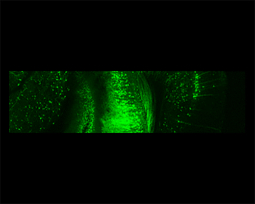 Thy1-YFP transgenic mouse brain – Logos Biosystems | Advanced Imaging ...