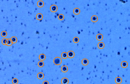 Optimizing PBMC Counting Accuracy with a New Approach in the LUNA-III™