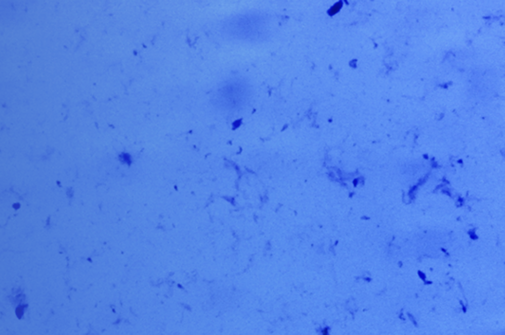 How to Minimize Trypan Blue Precipitation – Logos Biosystems