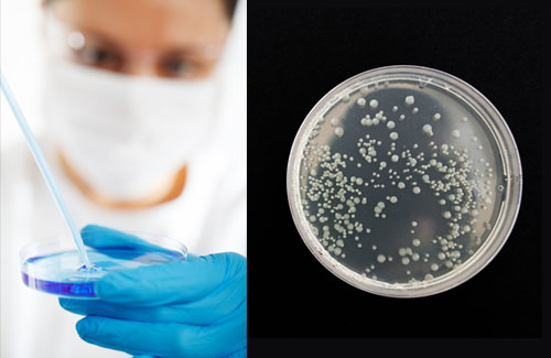 The Art of Bacteria Counting: From OD600 to Single Cell Counting